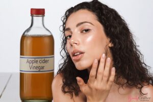 How to Use Apple Cider Vinegar for Rashes - Beauty Crafter